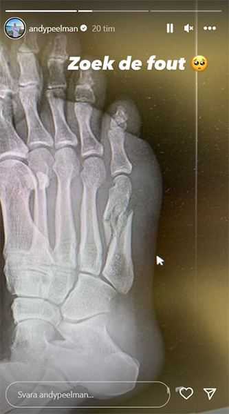 Het loopt helemaal fout voor Andy Peelman: Hij belandt in het ...